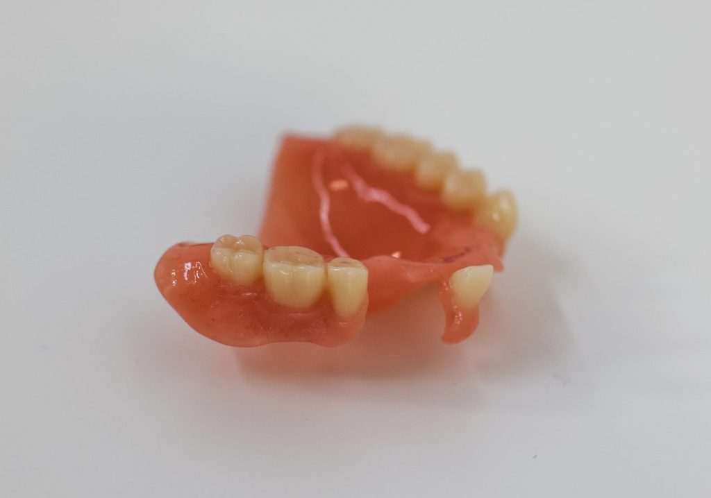 Partiële Prothese, comfortabel en functioneel- MondPro